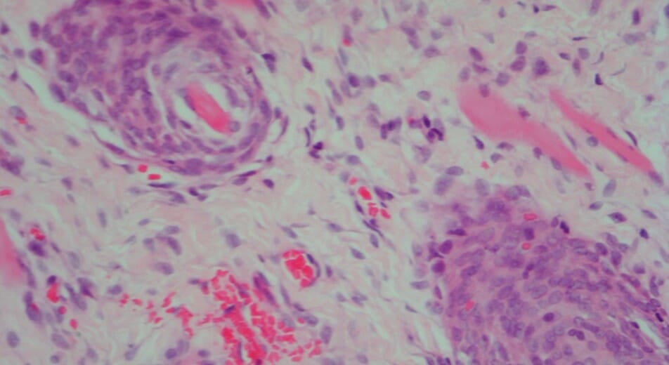 Soft tissue sarcoma: case study | Veterinary Practice